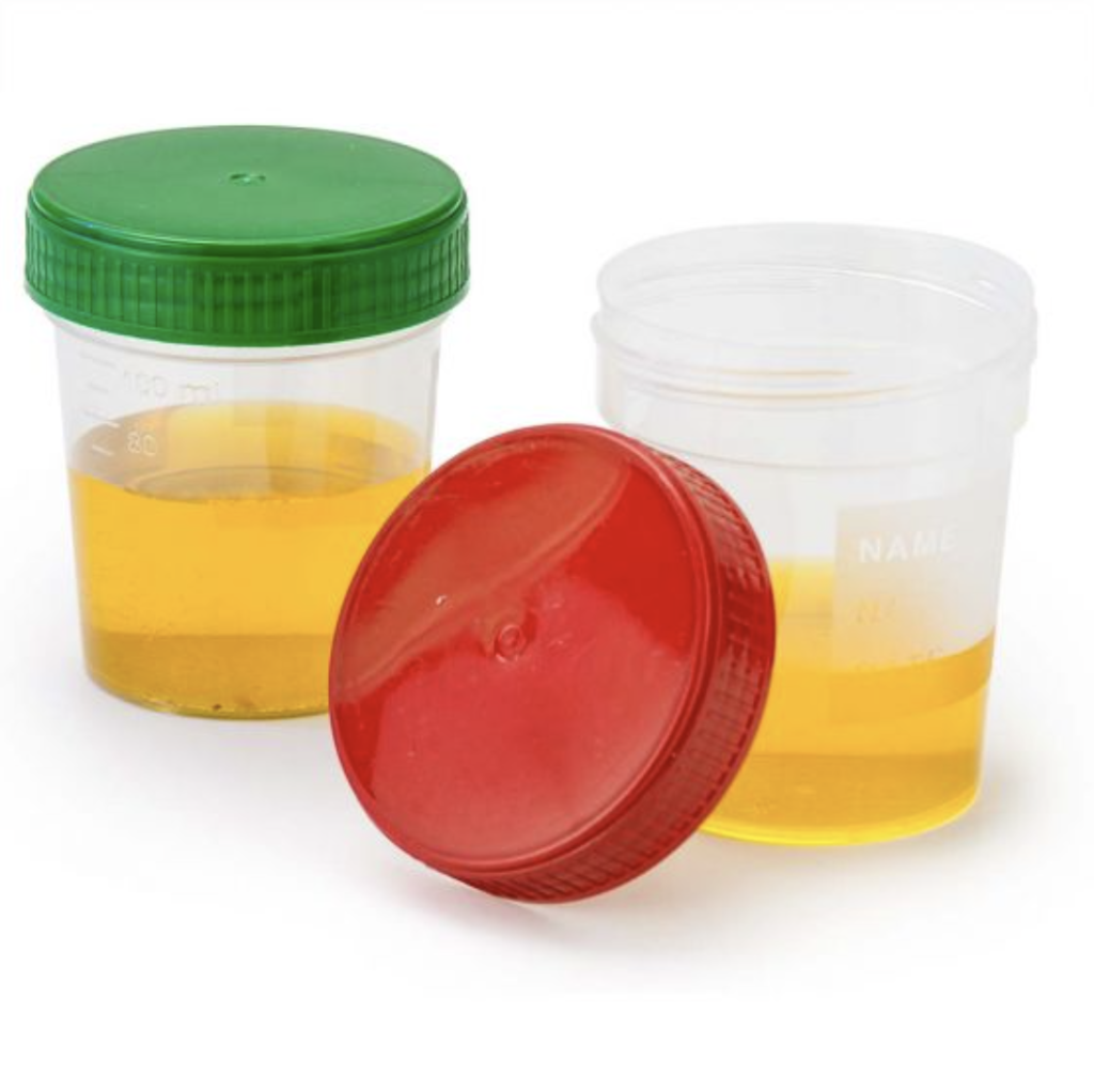 Urine Collection Cups for On-Site Collection & Testing - Kyron Sciences ...